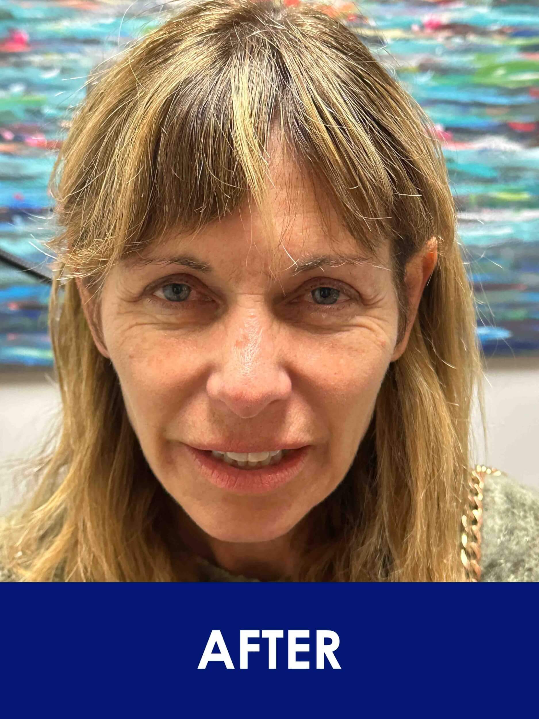 Proliance Surgeons Bellevue Ear, Nose & Throat Lake Washington Facial ...