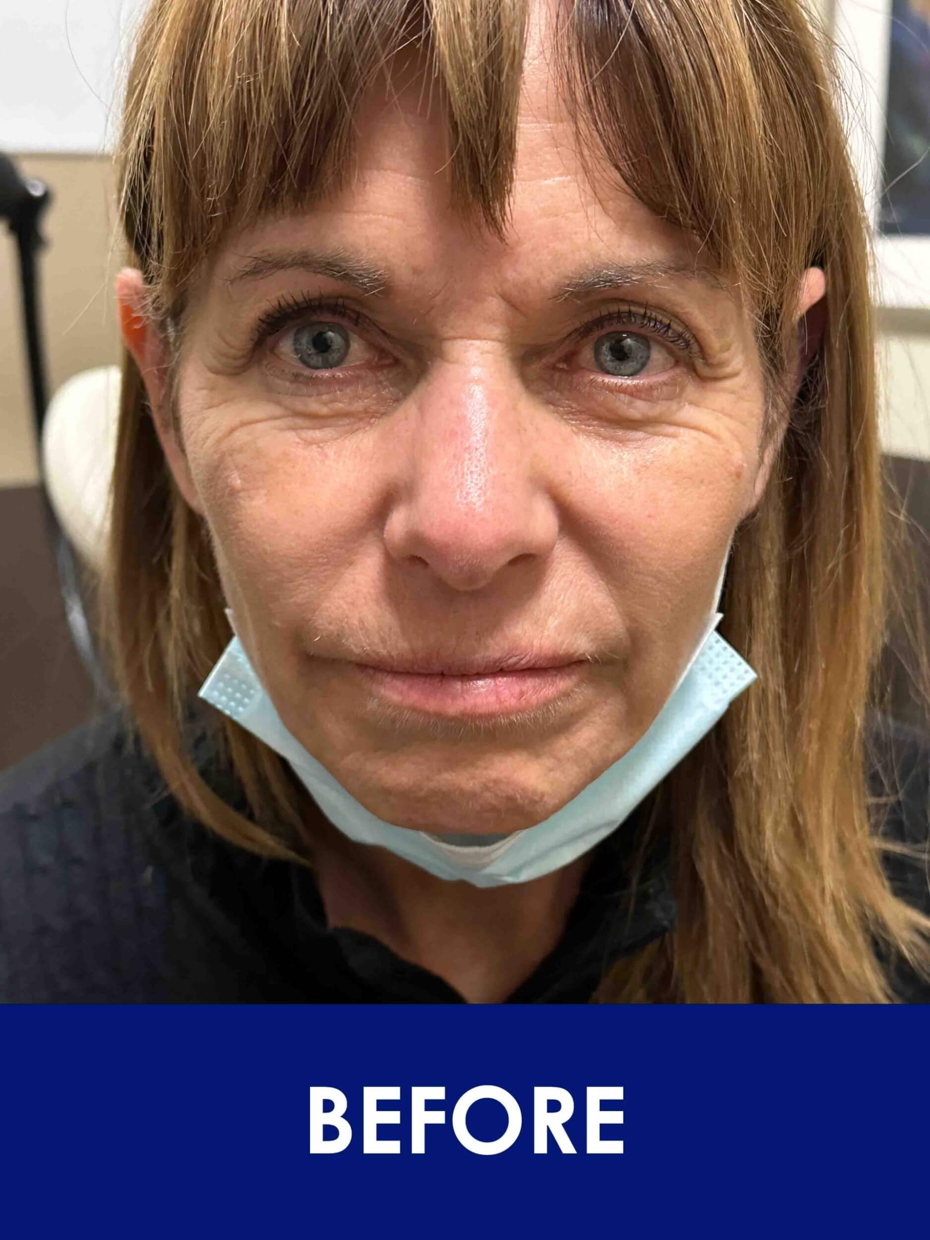 Proliance Surgeons Bellevue Ear, Nose & Throat Lake Washington Facial ...