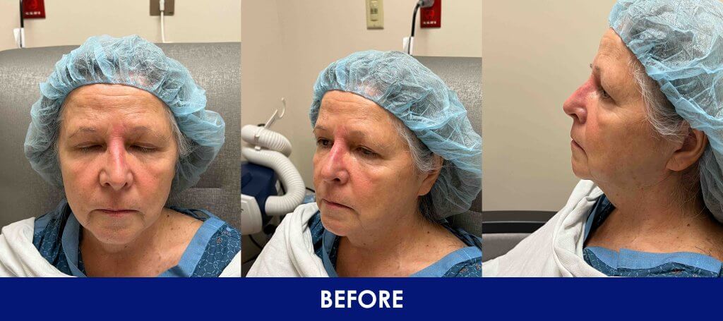 Proliance Surgeons Bellevue Ear Nose Throat Lake Washington Facial