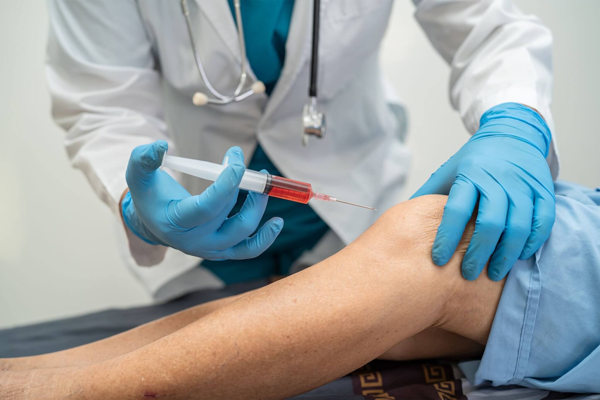 PRP | Platelet-Rich Plasma Injections | Proliance Surgeons